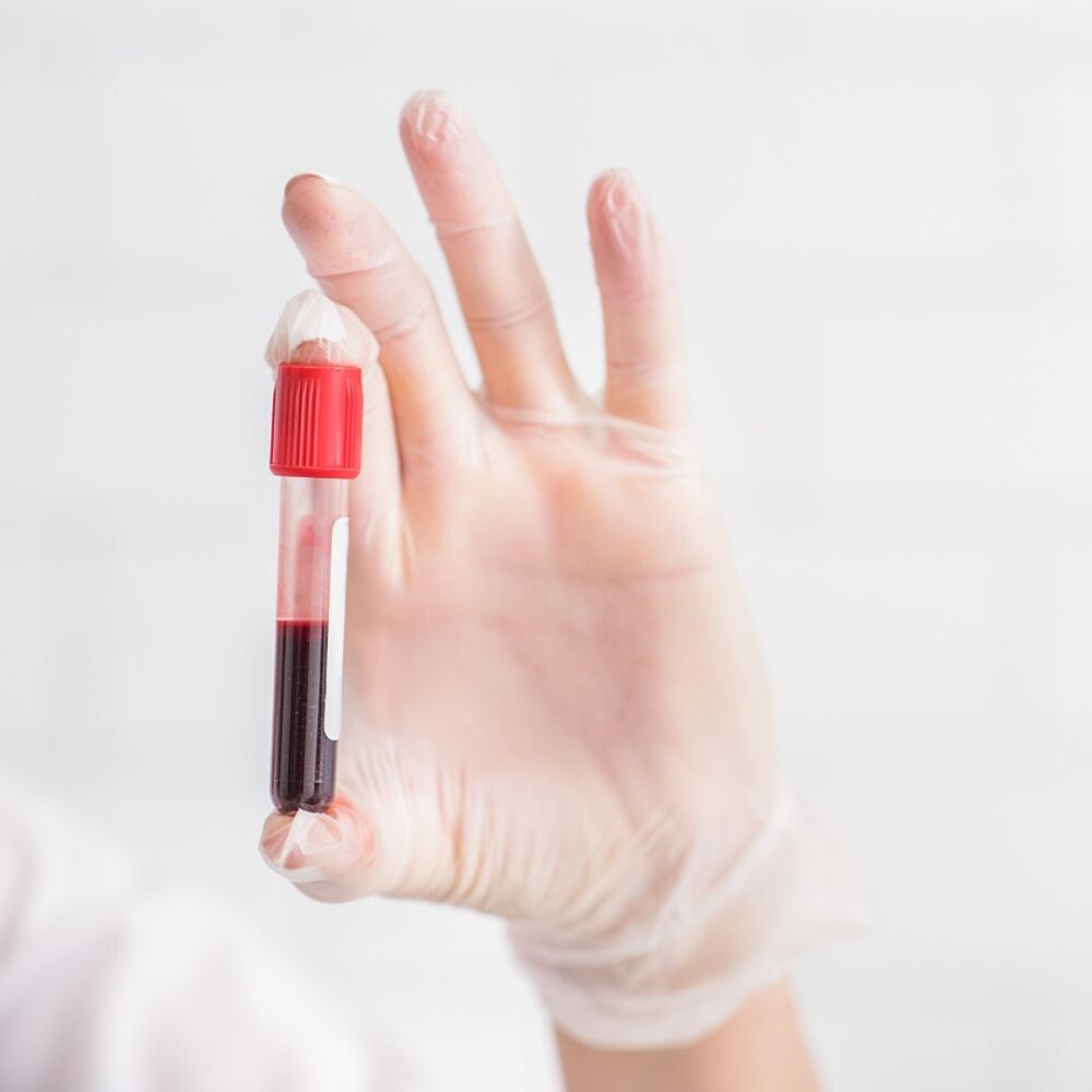 Treatment of iron deficiency - guidelines for diagnosis and therapy